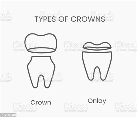 크라운의 선형 아이콘 유형입니다 치과 진료소를 위한 벡터 일러스트 레이 션 개념에 대한 스톡 벡터 아트 및 기타 이미지 개념 건강관리와 의술 건강한 생활방식 Istock