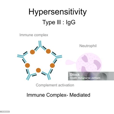 Ilustración De El Diagrama De Hipersensibilidad Tipo Lll Complejo Inmune Mediado Que Muestra El