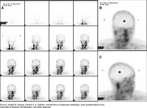 Introduction To Nuclear Medicine Radiology Key