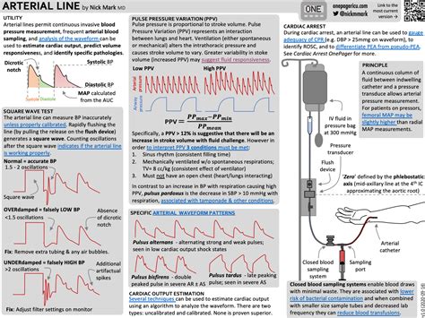 Arterial Lines And Waveforms Arterial Lines Permit Continuous Grepmed