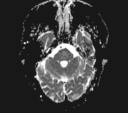 Image Radiopaedia Org