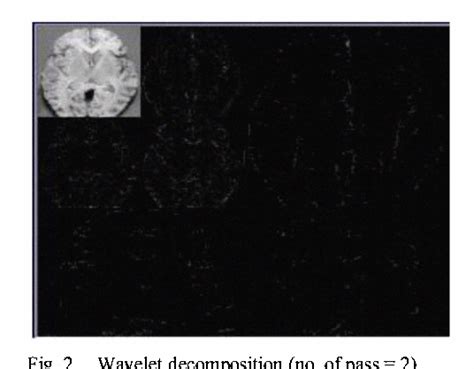 Figure 2 From Hybrid Transform Coding Scheme For Medical Image