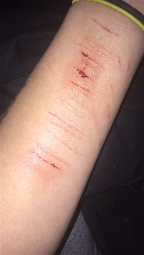 Real Cut Wrists