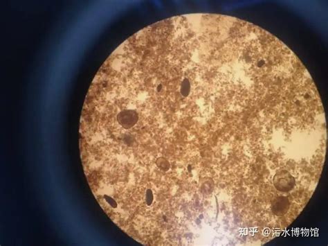 污水处理一千零一问（69）：活性污泥法在污水处理领域有哪些用途？ 知乎