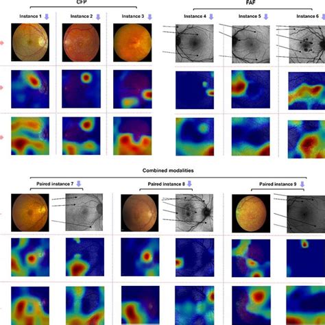 Deep Learning Attention Maps Overlaid On Representative Image Examples Download Scientific