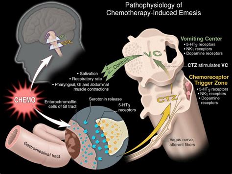 Ppt Chemotherapy Induced Nausea And Vomiting Cinv Causes Challenges Evaluation And
