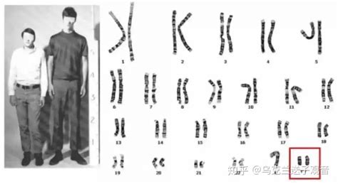 关于人类染色体核型报告解读及相关案例简述 Lrc 知乎
