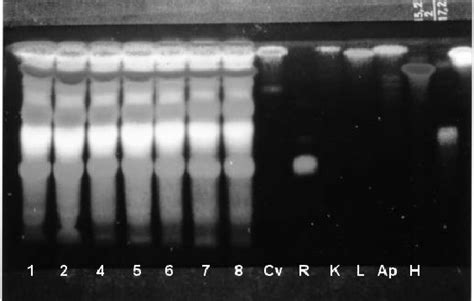 Chromatogram Of Flavones And Hypericin Content In Hypericum Perforatum