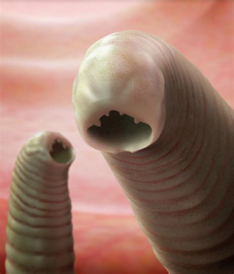 Hookworms Photograph By Tim Vernon Science Photo Library Fine Art