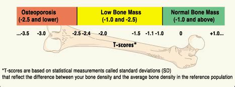 What Do Bmd Test Results Mean Nysopep Osteoporosis Nutrition