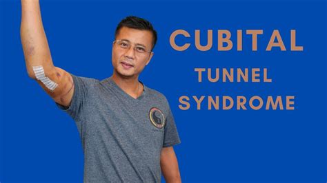 Cubital Tunnel Syndrome Ulnar Nerve Compression Before And After