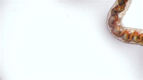 590 Tapeworm Stock Videos And Royalty Free Footage Istock