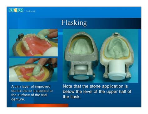 27 Denture Processing
