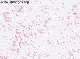 Home Infectious Disease Images
