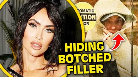 Celebrities That Became Botched From Bad Plastic Surgery Bad Plastic