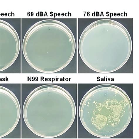 A Optical Density Measurements As An Indicator Of Bacteria Download Scientific Diagram