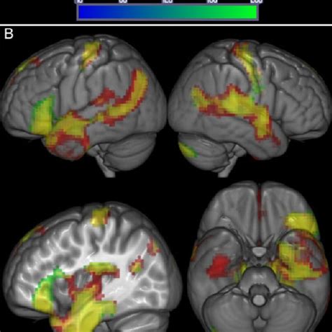 A Average Temporal Signal To Noise Ratio For The Smoothed Group Echo