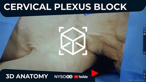 Cervical Plexus Block Nysoras 3d Anatomy Video Youtube