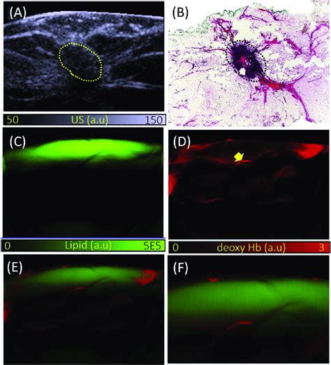 Ultrasound Guided Optoacoustic Tomography Us Ot Characteristics Of