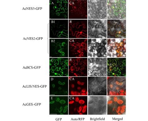 Subcellular Localisation Of Actps In Protoplasts Actps Gfp