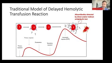 Simultaneous Session 1 Hyperhemolysis What It Is How To Treat It How