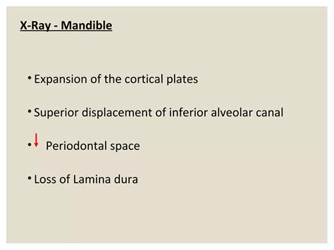 Fibro Osseous Lesions Ppt Bone And Joint Conditions Diseases And Conditions