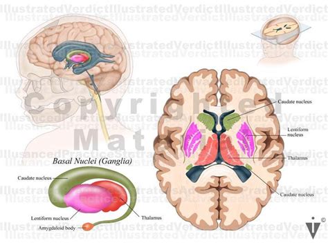 Basal Ganglia Axial Anatomy