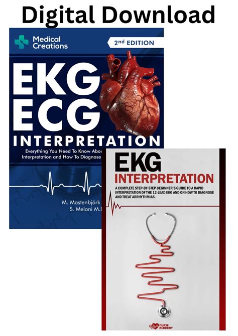 Ecg Explained Electrocardiogram Explained Understanding Ecg Interpreting An Ekg