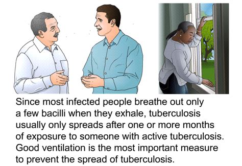 Tuberculosis
