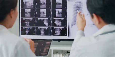 Distant Metastatic Nsclc Associated With Higher Overall Survival Than De Novo Cases