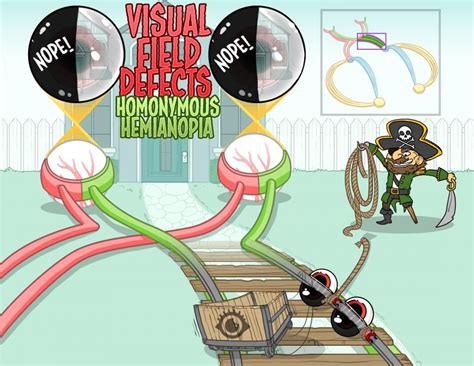 Homonymous Hemianopsia Osmosis