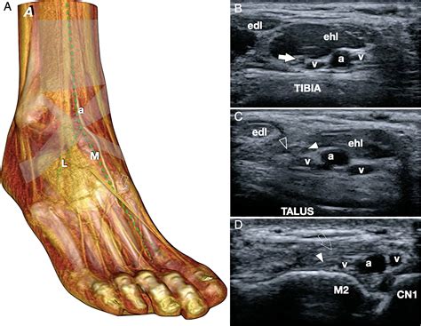 Superficial Peroneal Nerve Sensory Distribution