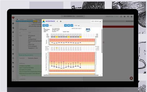 Resources Archives Ekora®