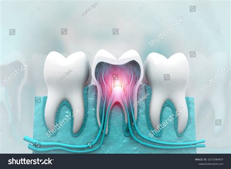 Human Tooth Structure Cross Section Pulp Stock Illustration 2273384937