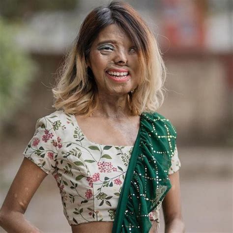 Bé Gái Bị Cha Tạt Axit Vì Không Phải Con Trai Khi Mới 2 Tháng Tuổi