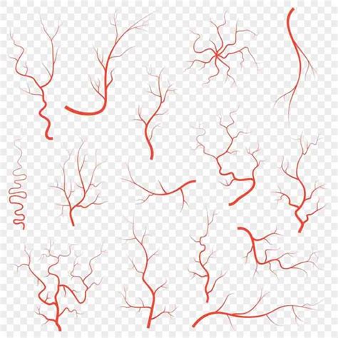 Vulvar Varicosities Diagnosis And Treatment Klarity Health Library