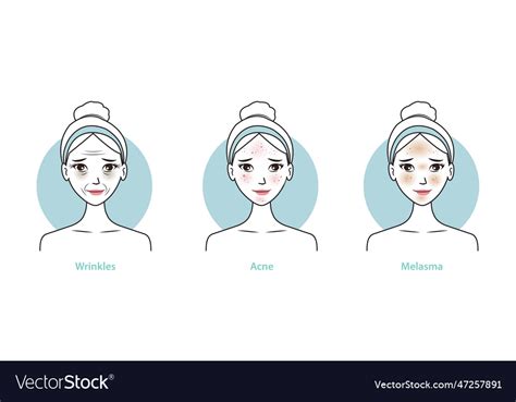 Skin Problems Set Royalty Free Vector Image Vectorstock