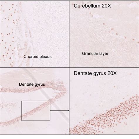 Immunostaining Of Neuronal Nuclei Download Scientific Diagram
