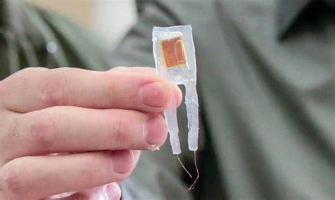 Bariatricsurgery Innovation Weightloss Healthtech Magneticimplants