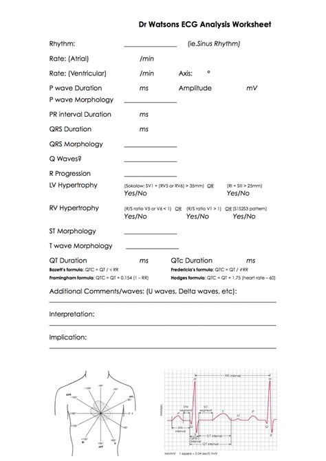 Cme Ecg Analysis Charlies Ed