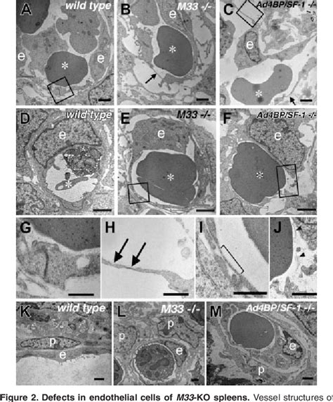 Figure 1 From Mouse Polycomb M33 Is Required For Splenic Vascular And