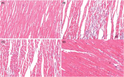 Myocardium Histology