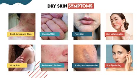Dehydrated Skin Symptoms