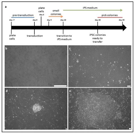 Scheme Of Induced Pluripotent Stem Cells Ipscs Generation From Download Scientific Diagram