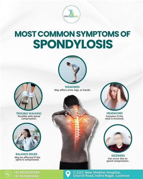Physio4u 🩺 Understanding Spondylosis Know The Signs Persistent