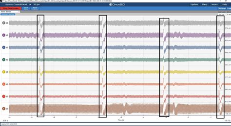 Signal Problem OpenBCI Forum