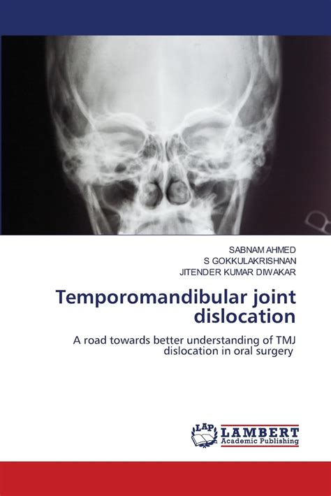 Temporomandibular Joint Dislocation A Road Towards Better Understanding Of Tmj Dislocation In