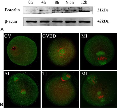 Figure 1 From Borealin Regulates Bipolar Spindle Formation But May Not