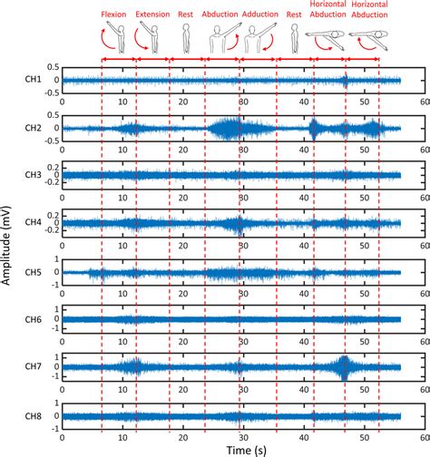 A High‐precision Dynamic Movement Recognition Algorithm Using