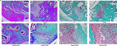 Improvement Of Polydopamine Loaded Salidroside On Osseointegration Of Titanium Implants Pmc